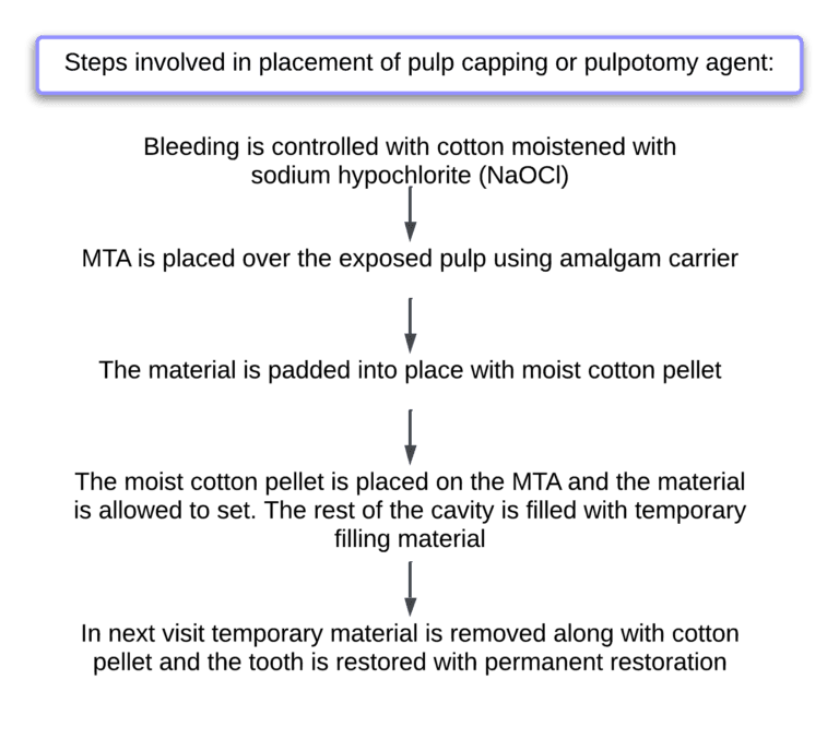 Mineral Trioxide Aggregate - DentaMasters